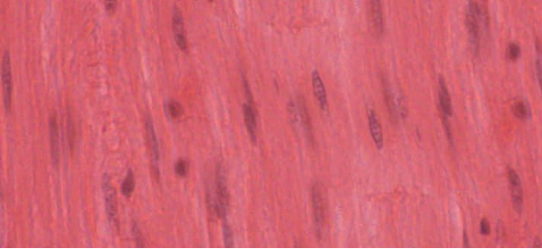 All Muscle Cells have a Sarcolemma