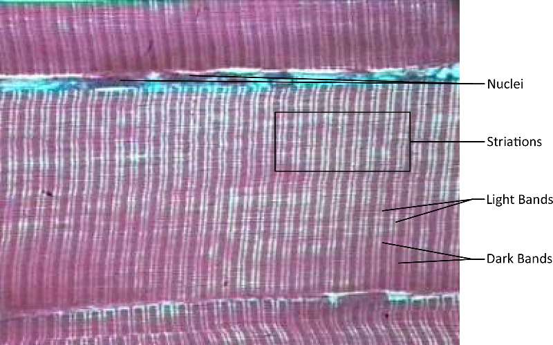 What is Muscle Tissue? What Different Types are There and Where are ...